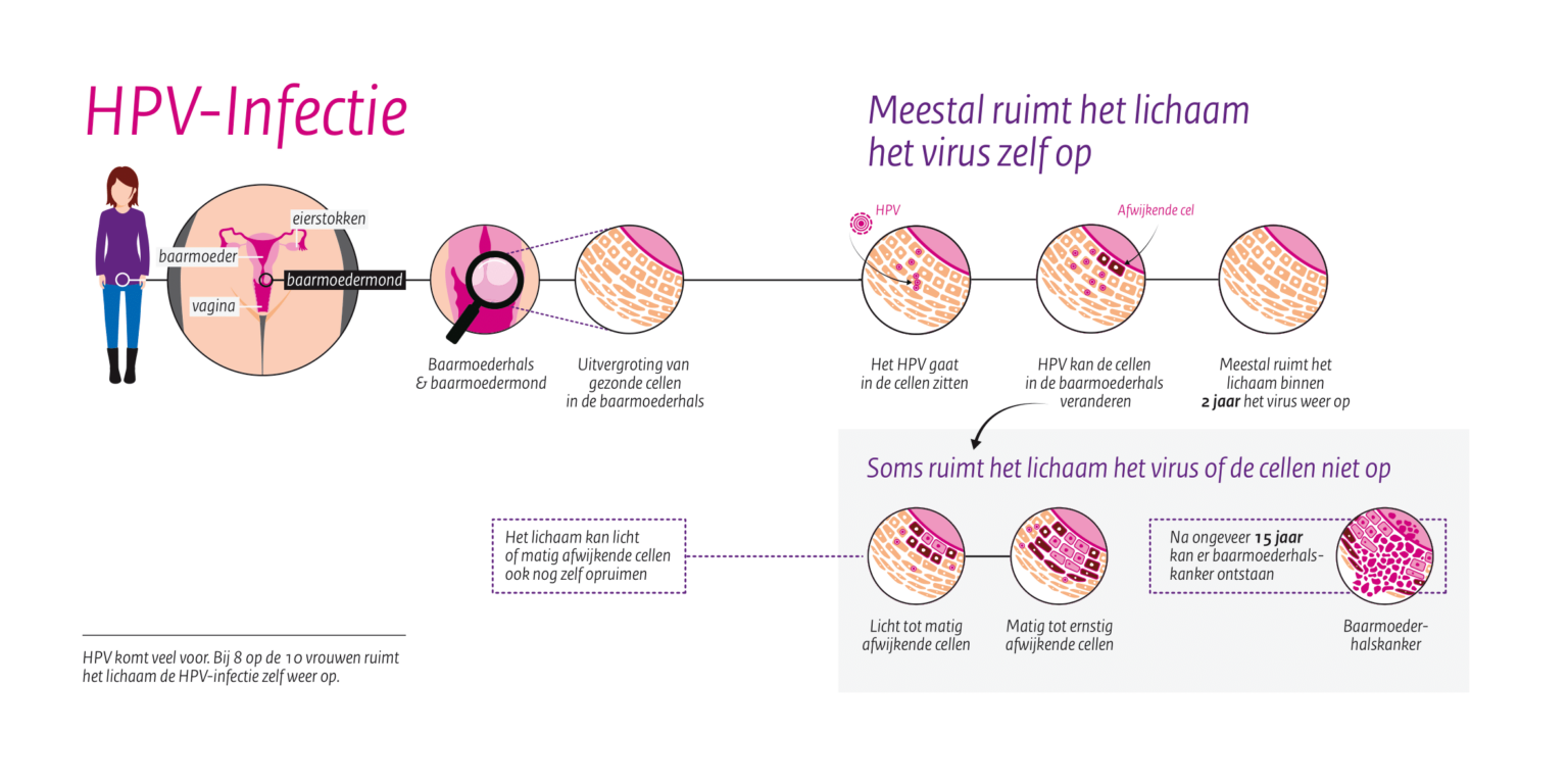 Alles dat je moet weten over een uitstrijkje, HPV en ...